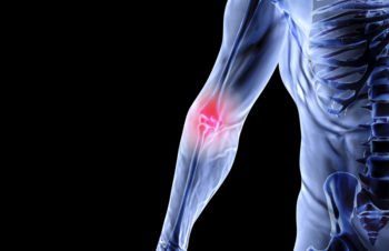 ¿Qué Tan Fuerte Tienes Que Golpear El Codo para Fracturarlo? | TJMBB