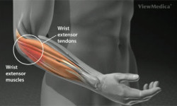 Overuse Elbow Injuries: Prevention, Treatment, & More